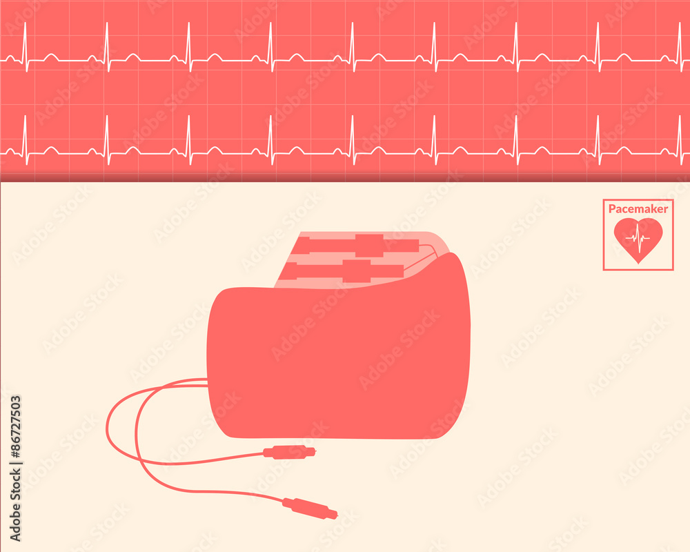 Red silhouette pacemaker and cardiogram background. Stock Vector ...