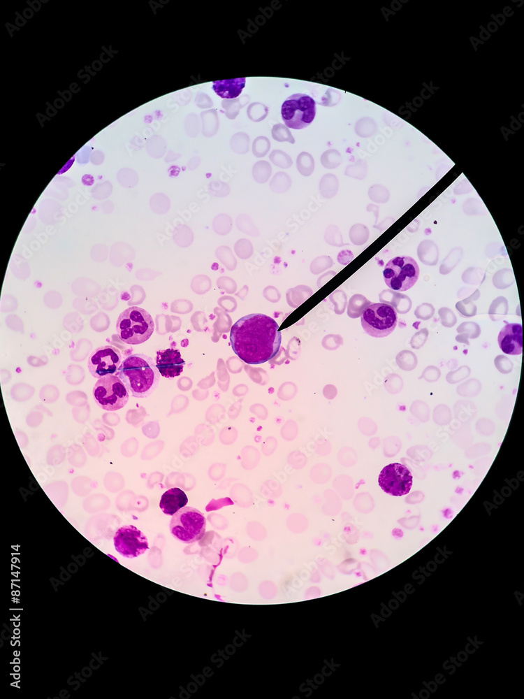 blood smear under microscope Stock Photo | Adobe Stock