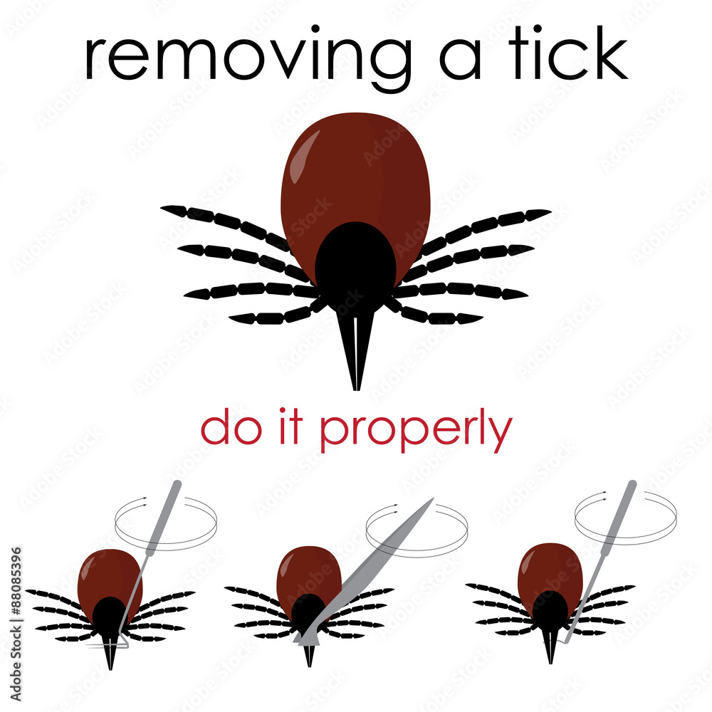 vector infographic illustration on how to properly remove a tick, and ...