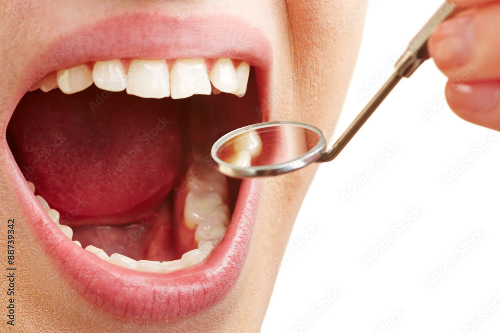 Foto de Frau beim Zahnarzt mit offenem Mund do Stock | Adobe Stock