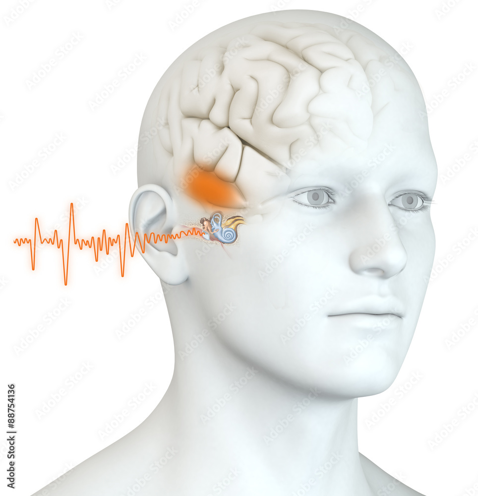 Tinnitus, 3D Illustration Stock-Illustration | Adobe Stock