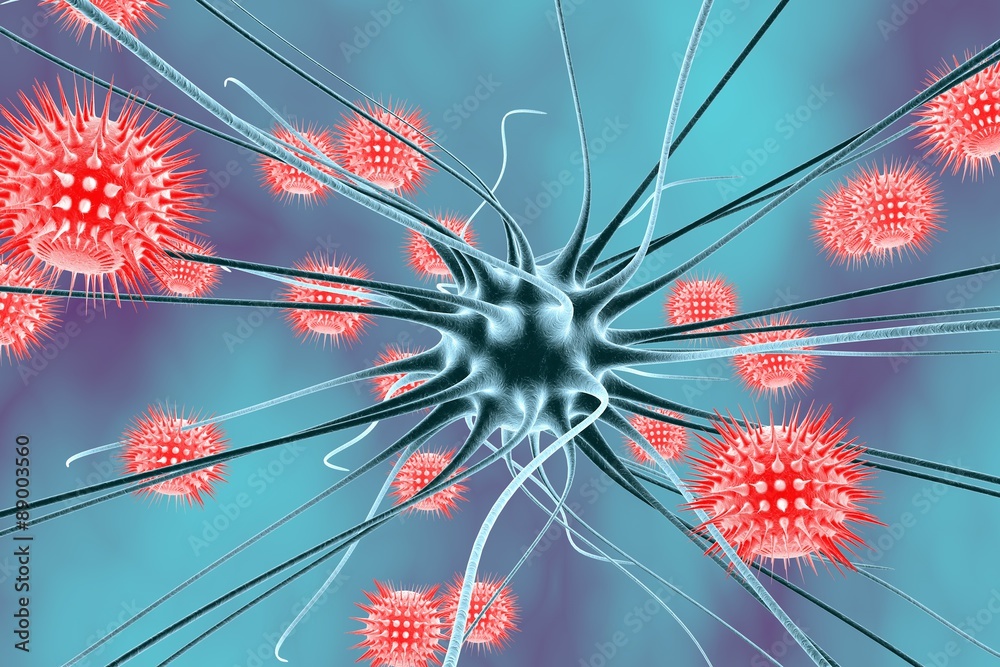 Viral encephalitis, neuroinfection, brain infection, neuron and viruses ...