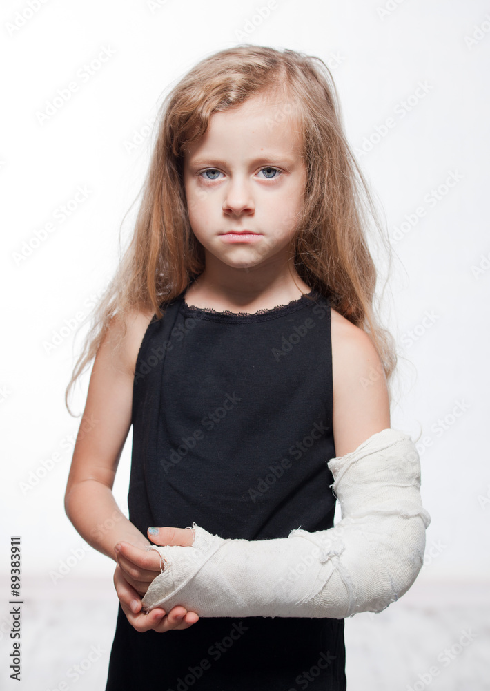 girl with a broken arm Stock Photo | Adobe Stock