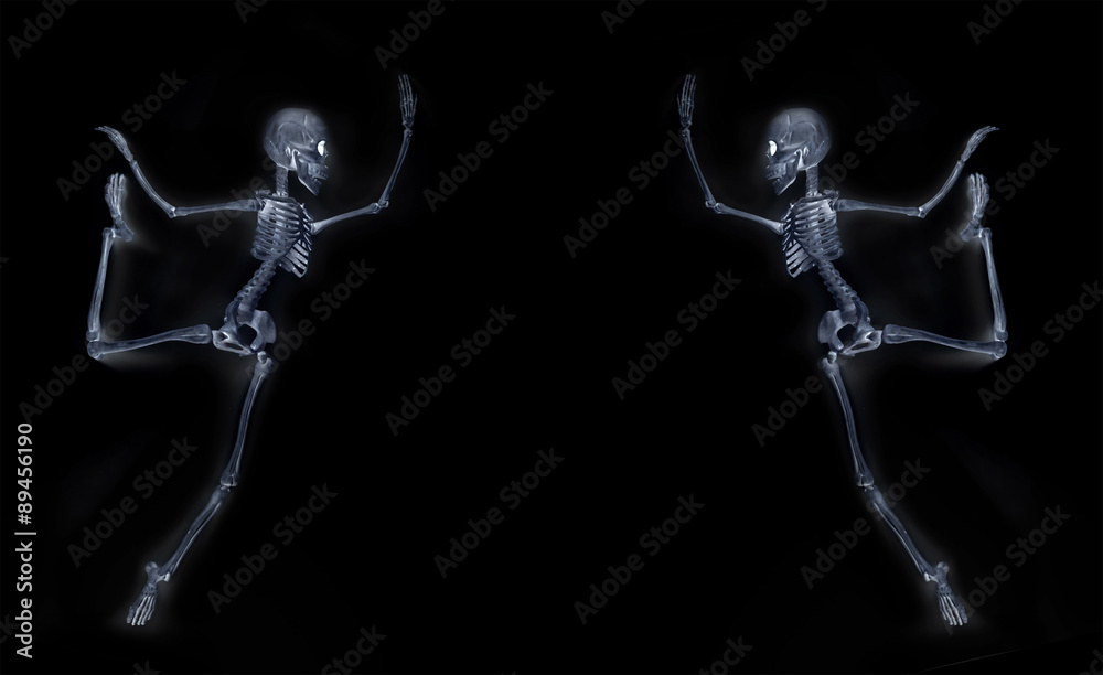 Dancing Skeleton X ray Stock Photo | Adobe Stock