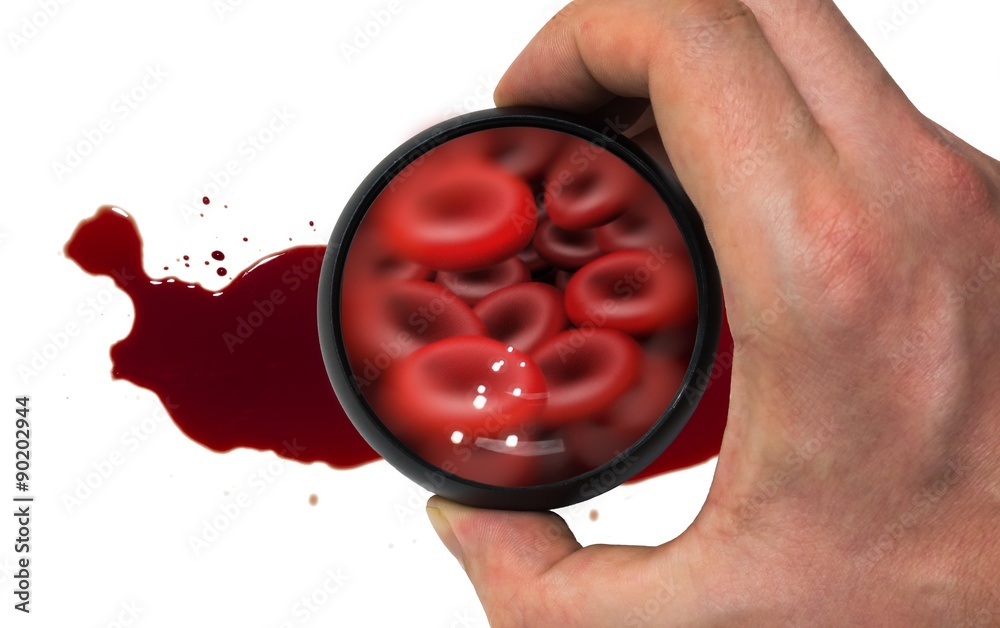 ภาพประกอบสต็อก Doctor's hand examining red blood cells with magnifier ...