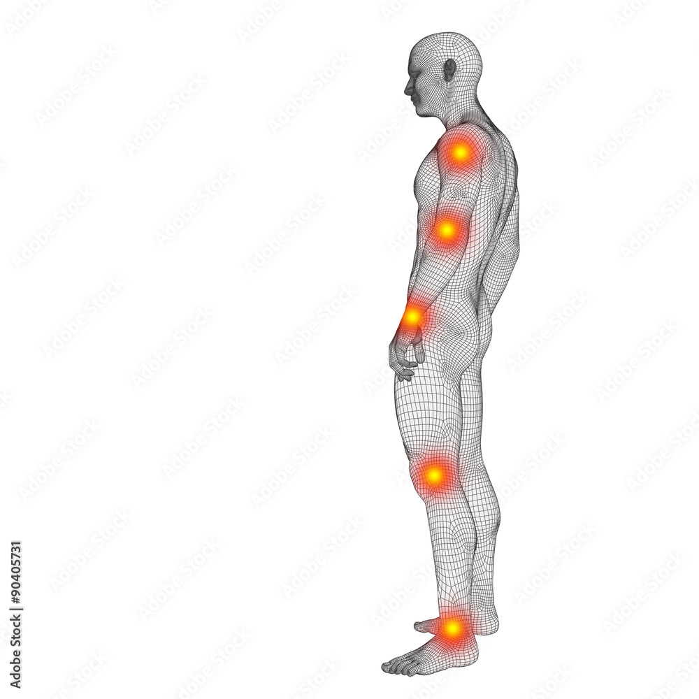 3D wireframe anatomy with pain Stock Illustration | Adobe Stock