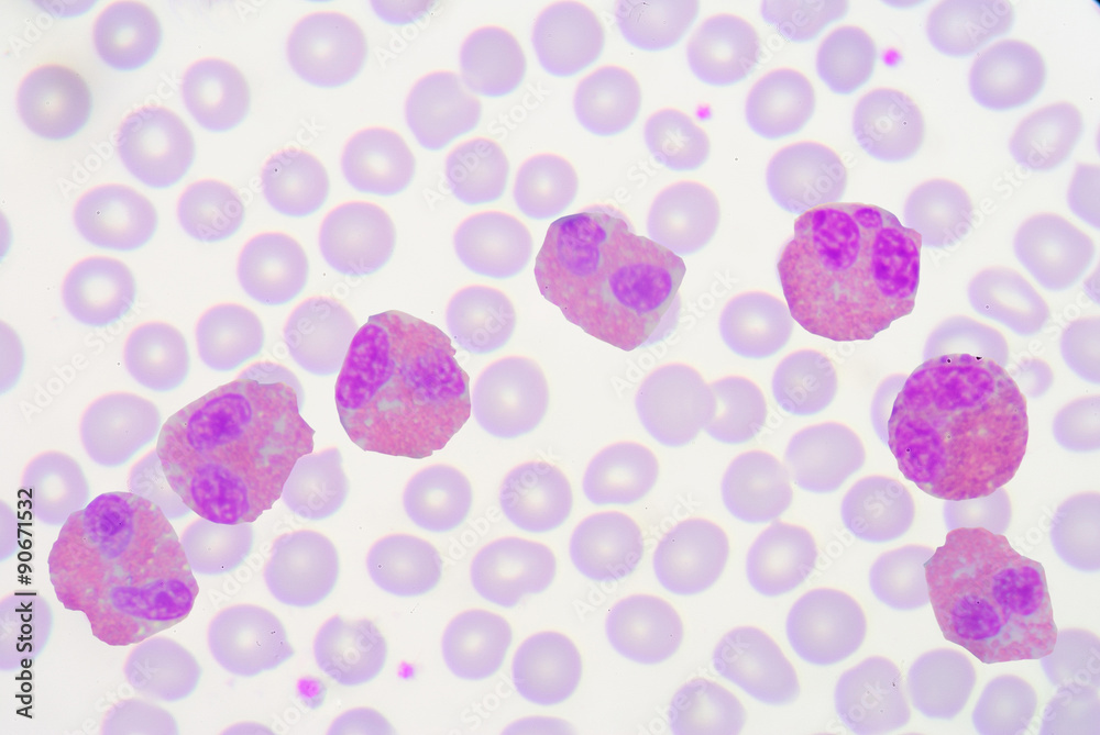 A blood smear is often used as a follow-up test to abnormal resu Stock ...