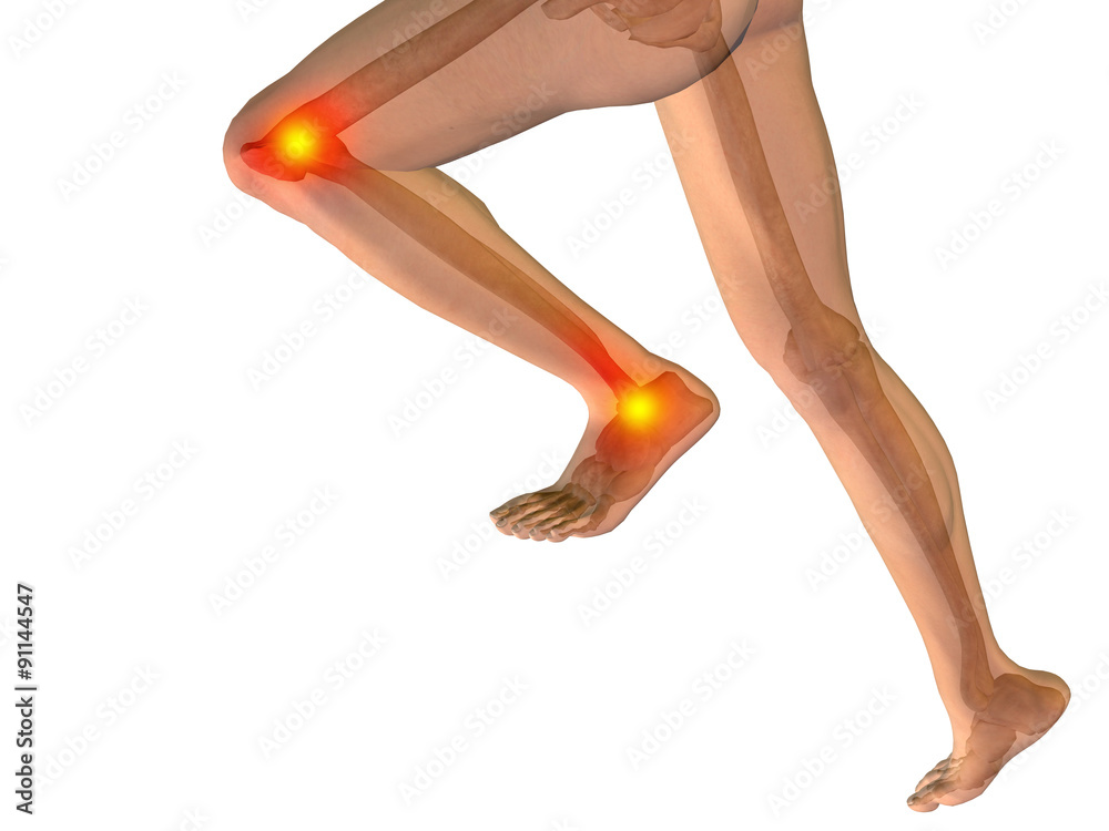 Conceptual human pain anatomy Stock Illustration | Adobe Stock