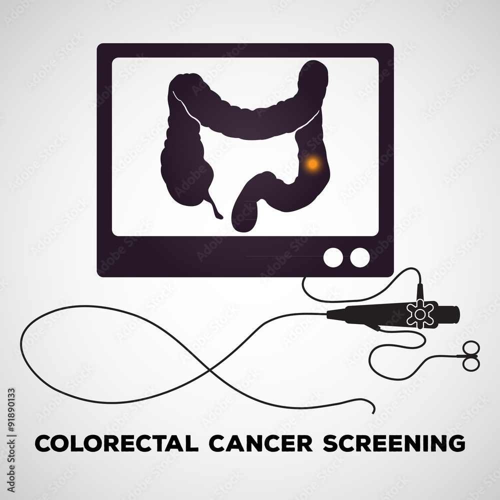 Colonoscopy procedure used for screening colon diseases Stock Vector ...