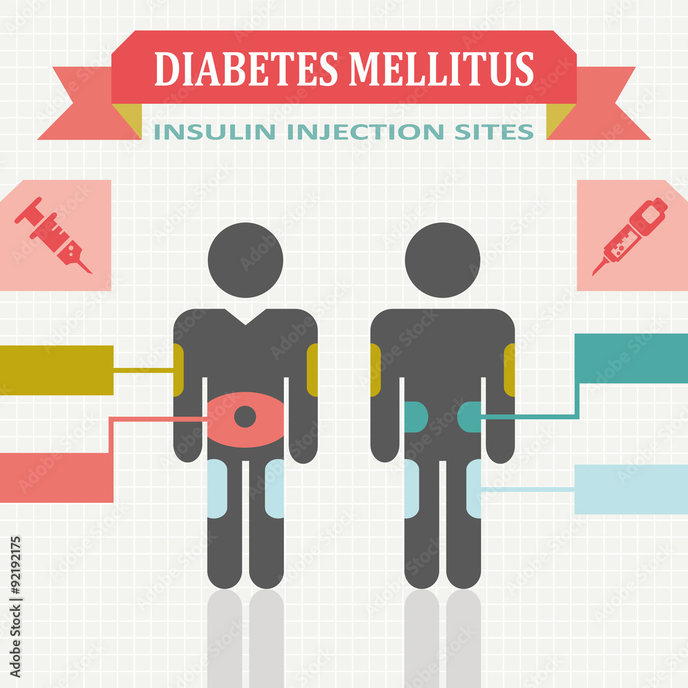Diabetes Mellitus Insulin Injection sites infographic icons Stock ...