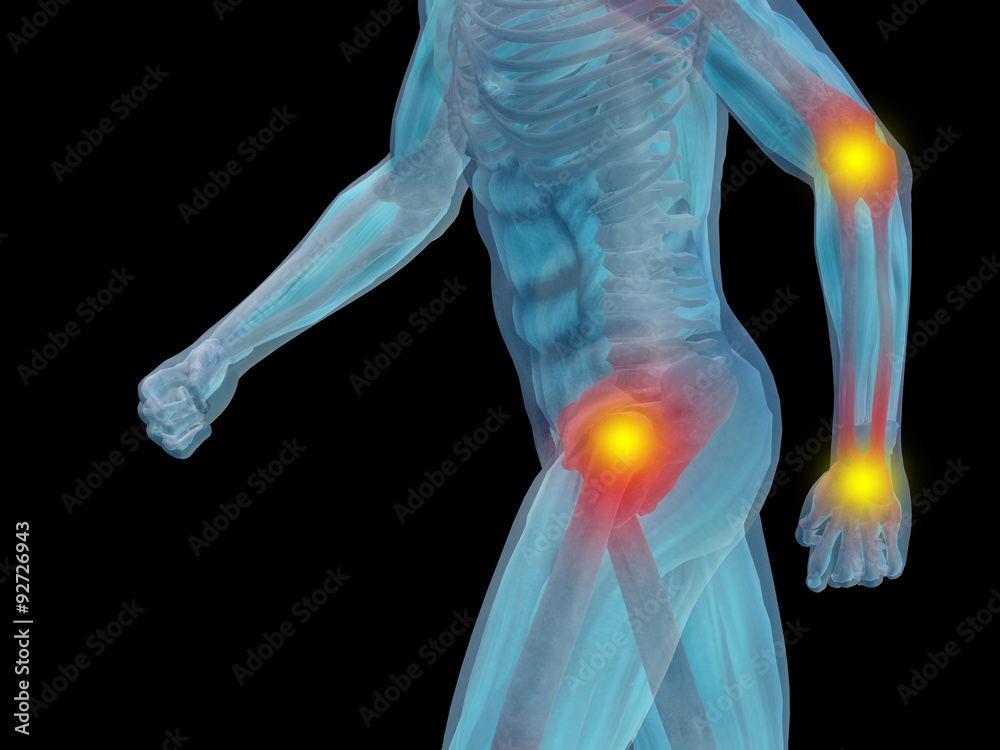 Conceptual human pain anatomy Stock Illustration | Adobe Stock