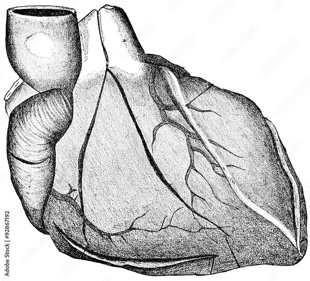 Heart showing the lines for incision in the preliminary examinat Stock ...
