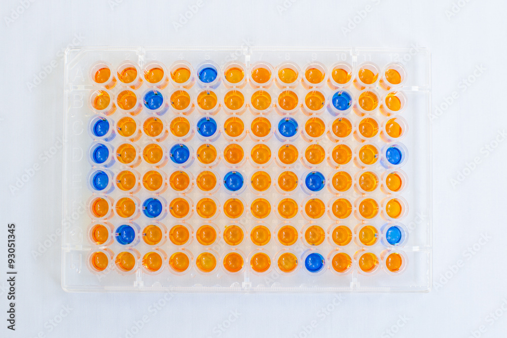 Enzyme-linked immunosorbent assay (ELISA), Immunology testing method in ...