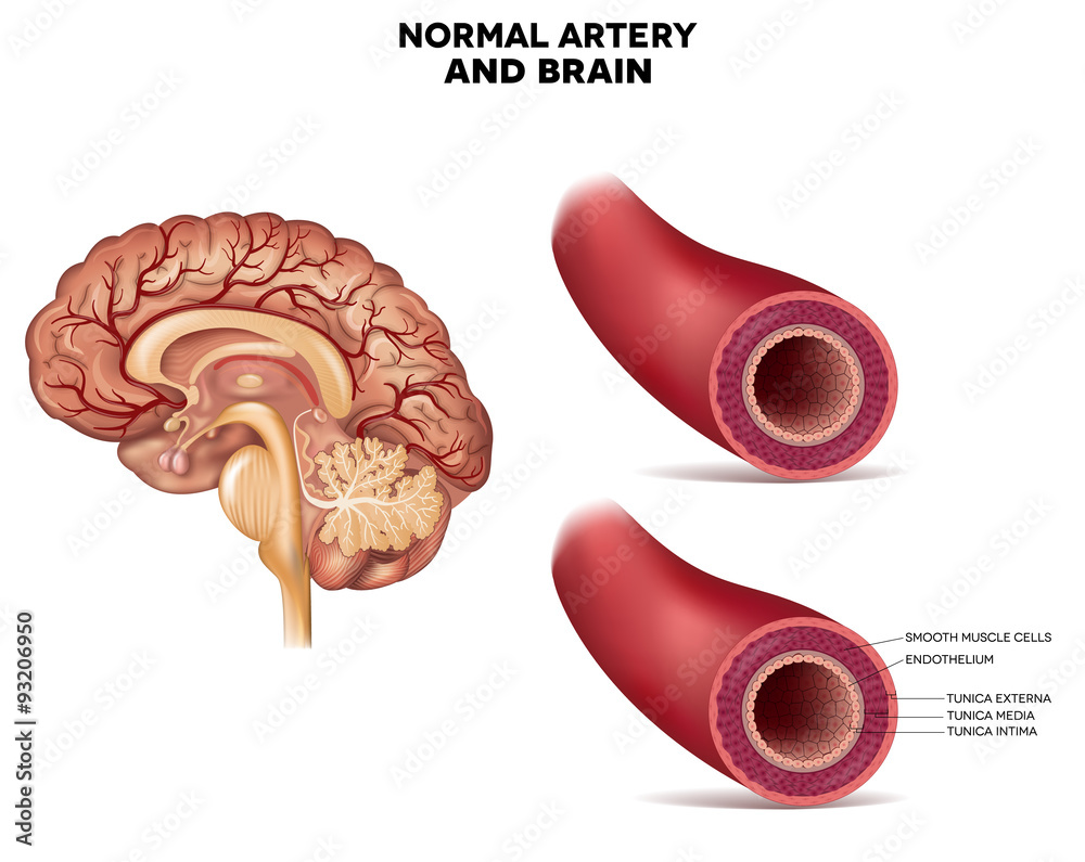 Normal artery structure and brain Stock Vector | Adobe Stock