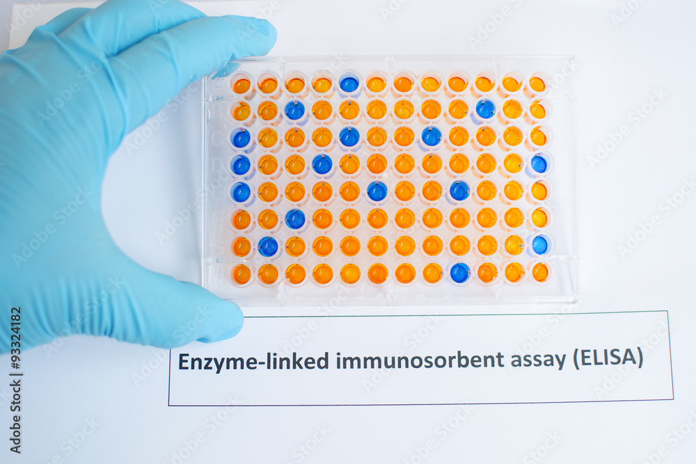 Enzyme-linked immunosorbent assay (ELISA), Immunology testing method in ...