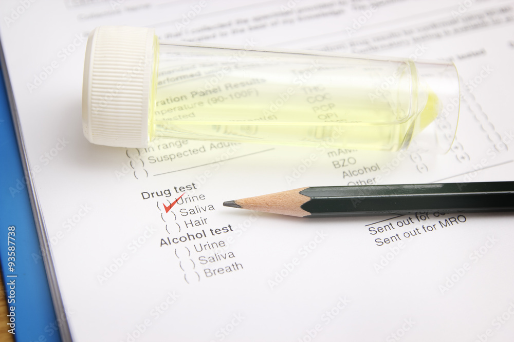 Drug test blank form with test kit and urine,focus on paper Stock Photo ...