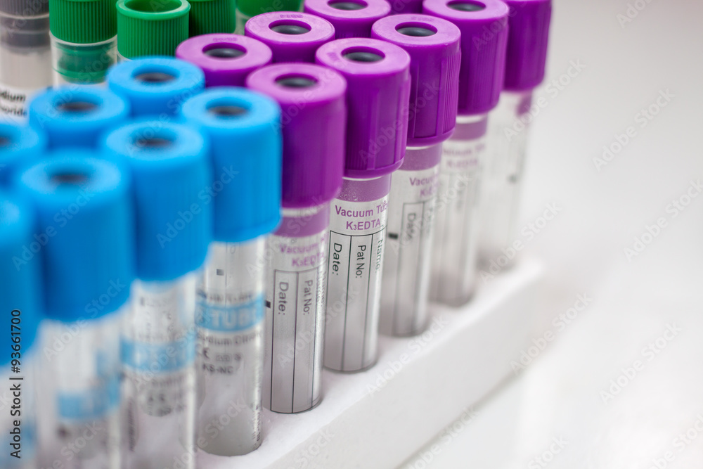 test tubes for testing Stock Photo | Adobe Stock