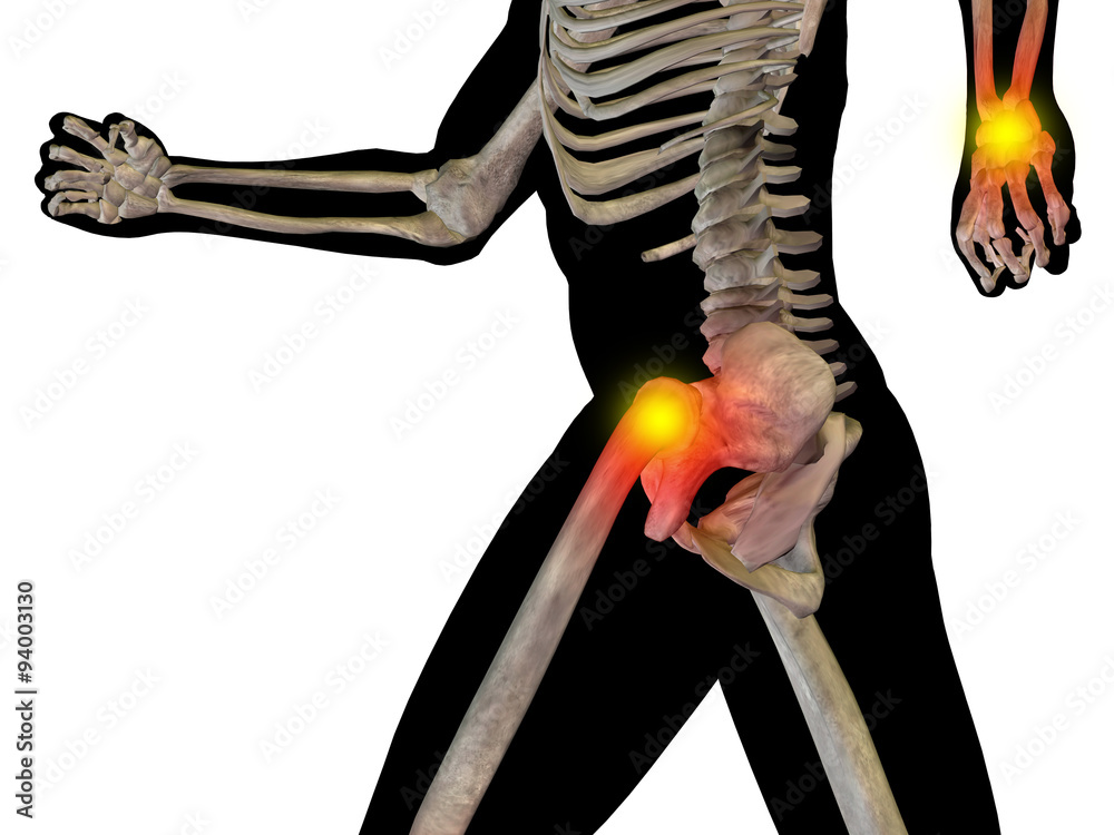 Conceptual human pain anatomy Stock Illustration | Adobe Stock