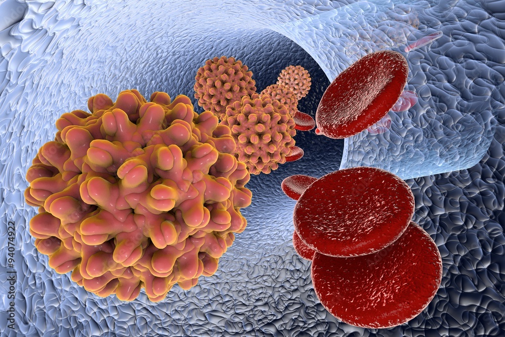 Hepatitis B virus in blood vessel with red blood cells. A model of ...