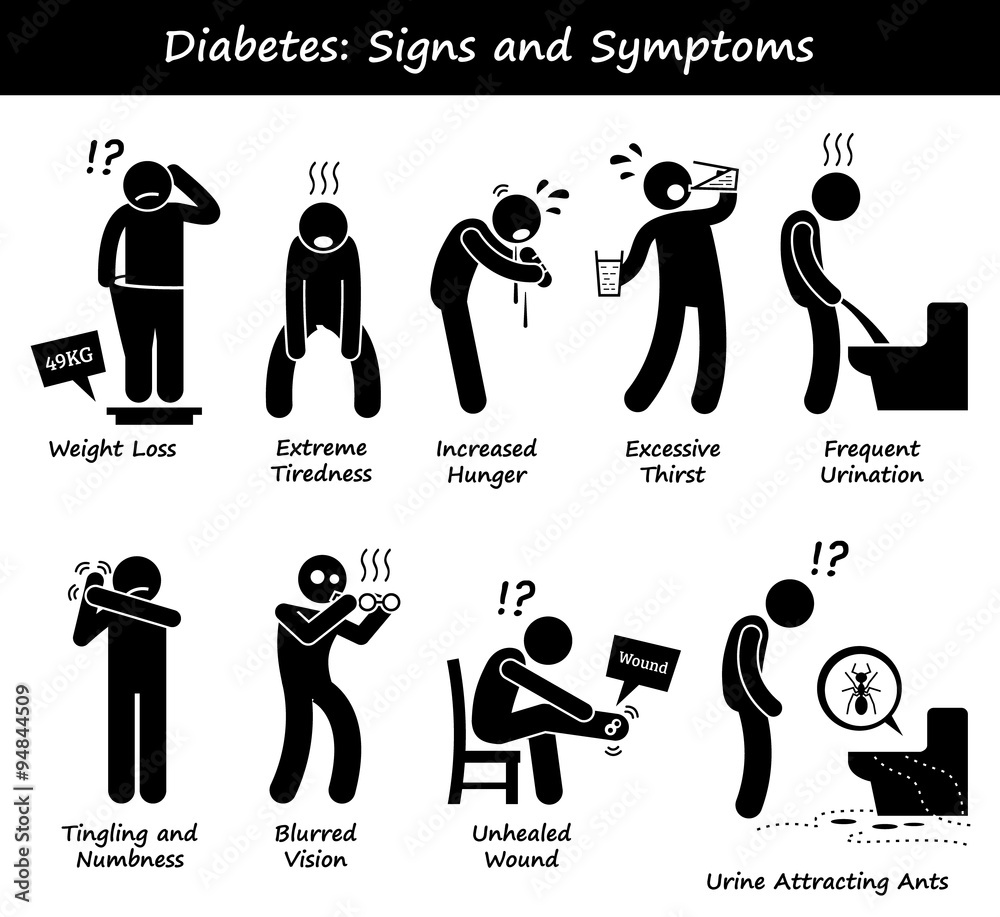 Diabetes Mellitus Diabetic High Blood Sugar Signs and Symptoms Stick ...