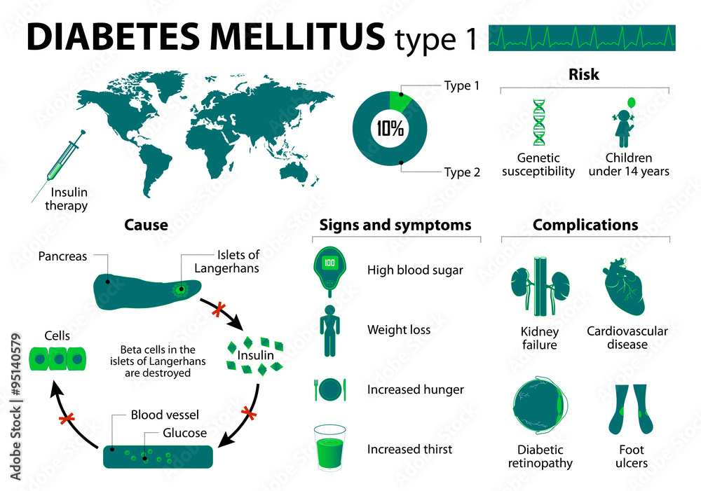 Diabetes mellitus type 1 Stock Vector | Adobe Stock