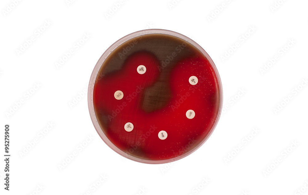 Antibiogram showing sensibility to Streptococcus pneumoniae bacteria on ...