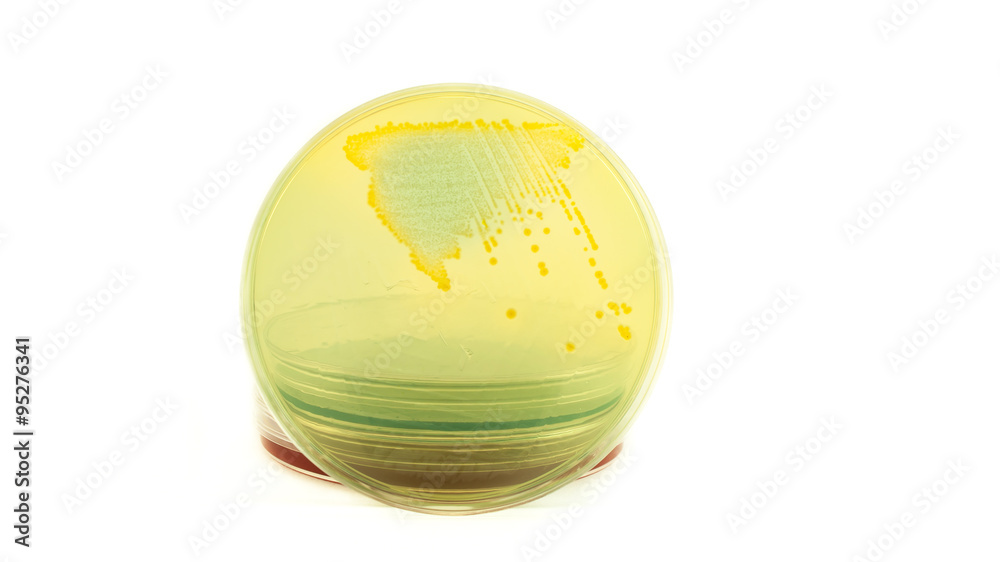 Escherichia Coli bacteria on Cled agar petri dish isolated on white ...