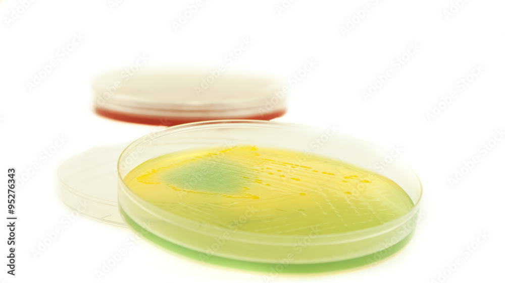 Escherichia Coli bacteria on Cled agar petri dish isolated on white ...