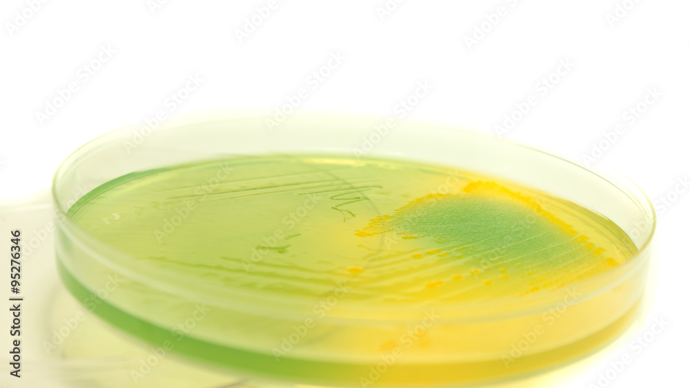 Escherichia Coli bacteria on Cled agar petri dish isolated on white ...