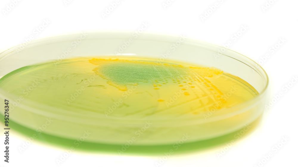 Escherichia Coli bacteria on Cled agar petri dish isolated on white ...