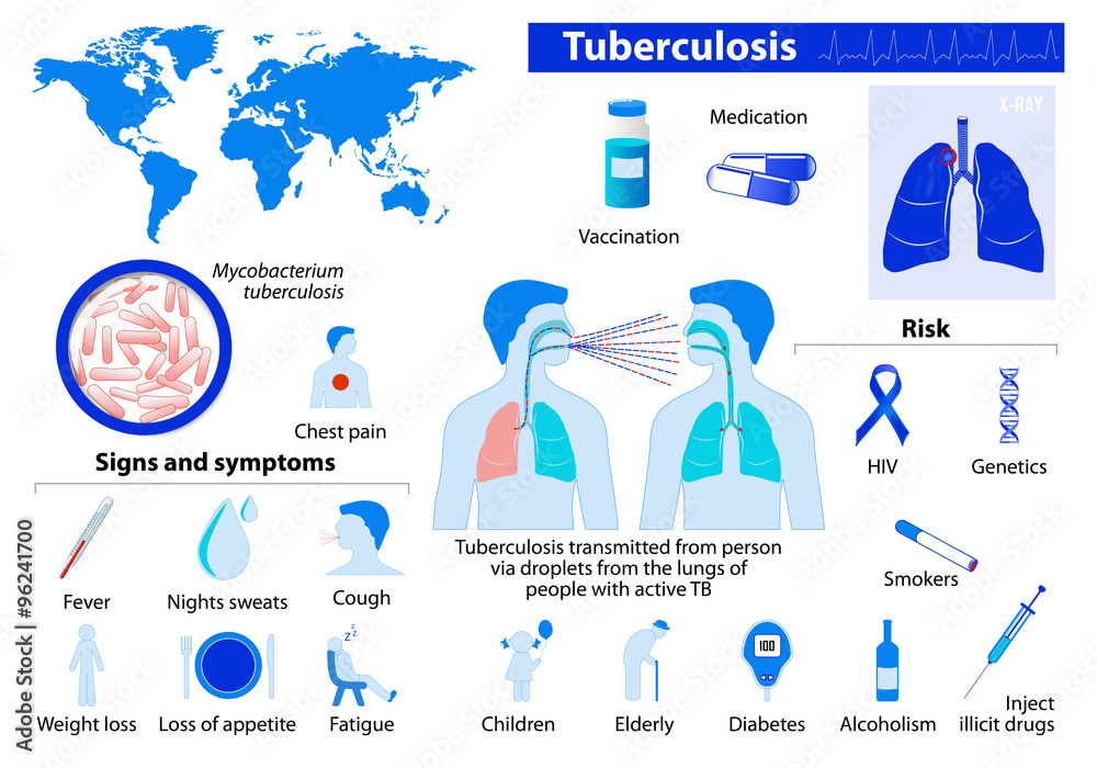 tuberculosis. Medical Infographic set elements and symbols for Stock ...
