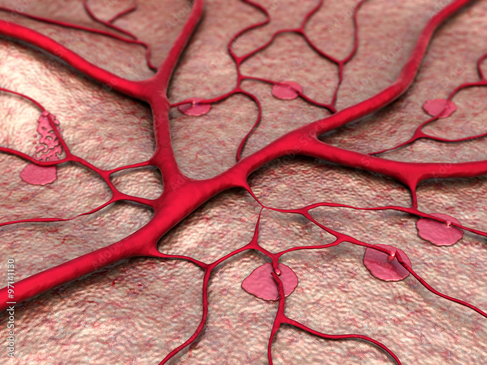 circulatory system, disease, heart attack, Capillary, circulatory ...