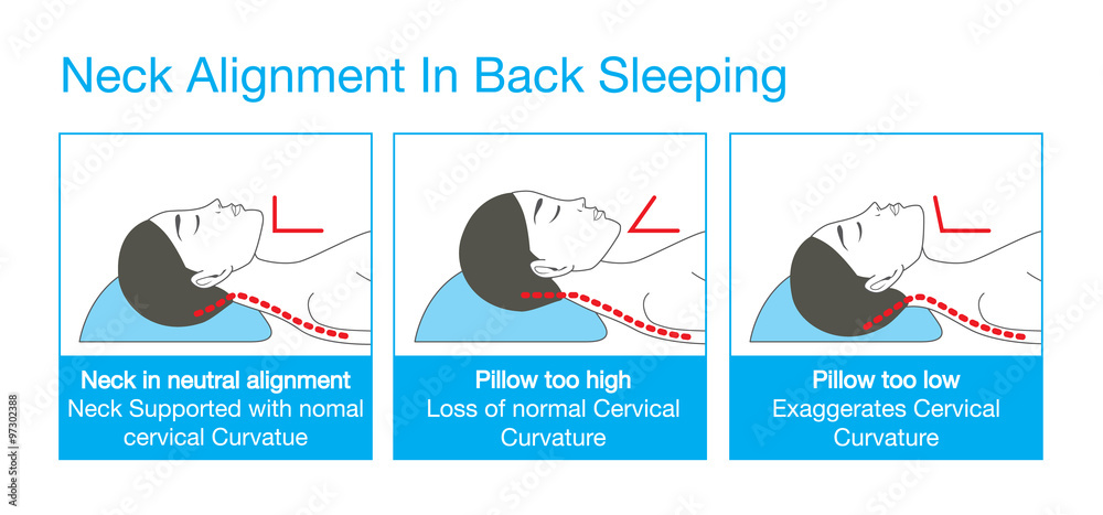 Right alignment of neck, head, and shoulder in sleep with back sleeping ...