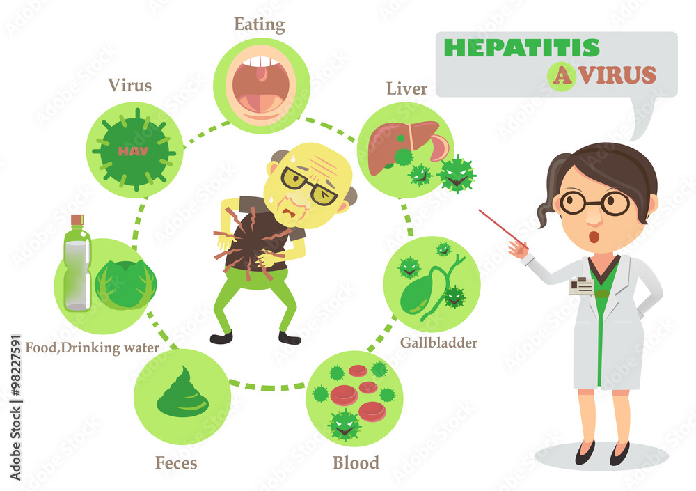 hepatitis a virus vector illustration Stock Vector | Adobe Stock