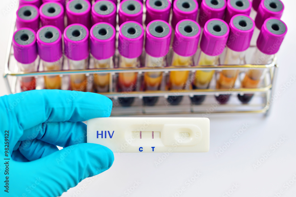 HIV testing by using test cassette, the result showed positive (double ...