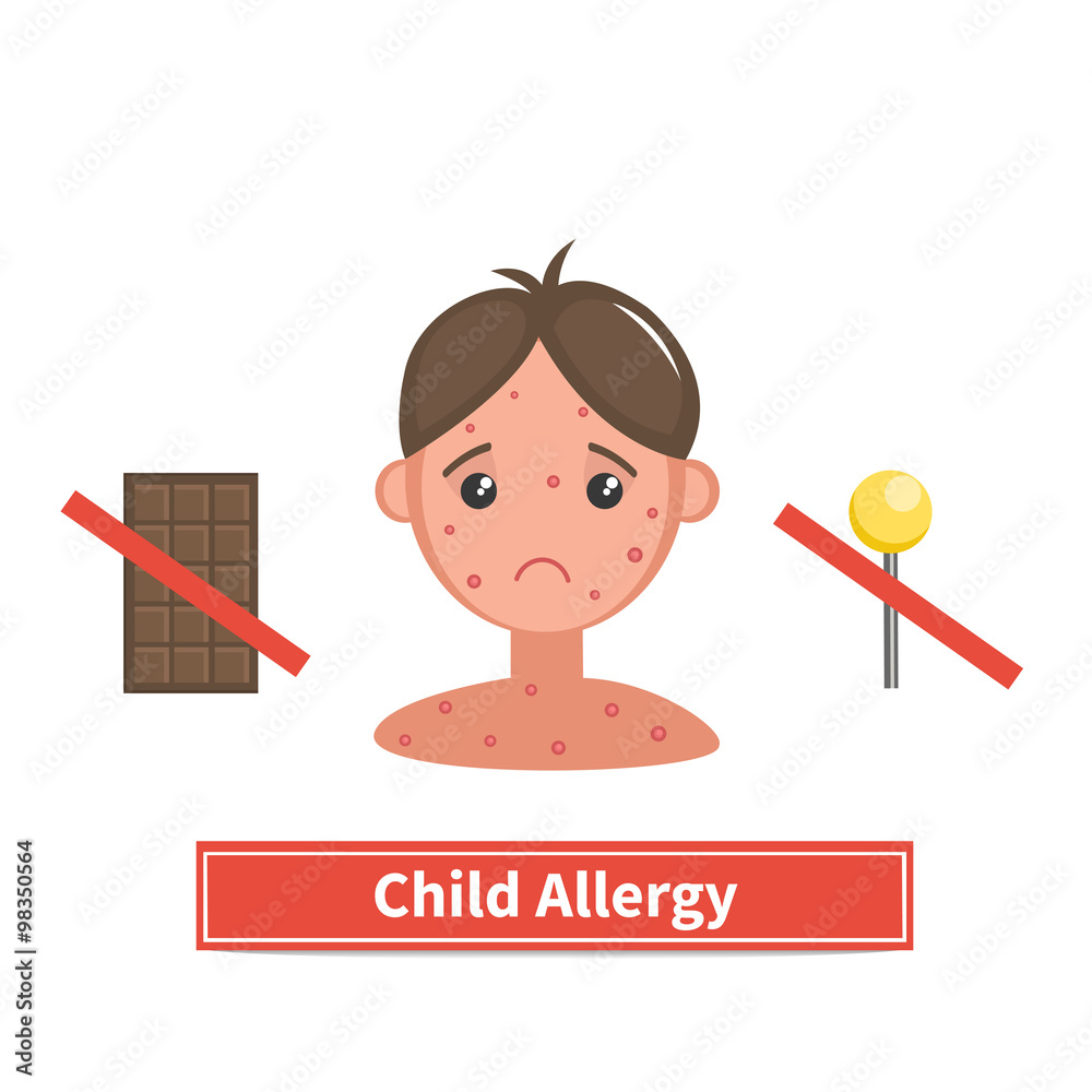 Child Allergy Stock Vector | Adobe Stock