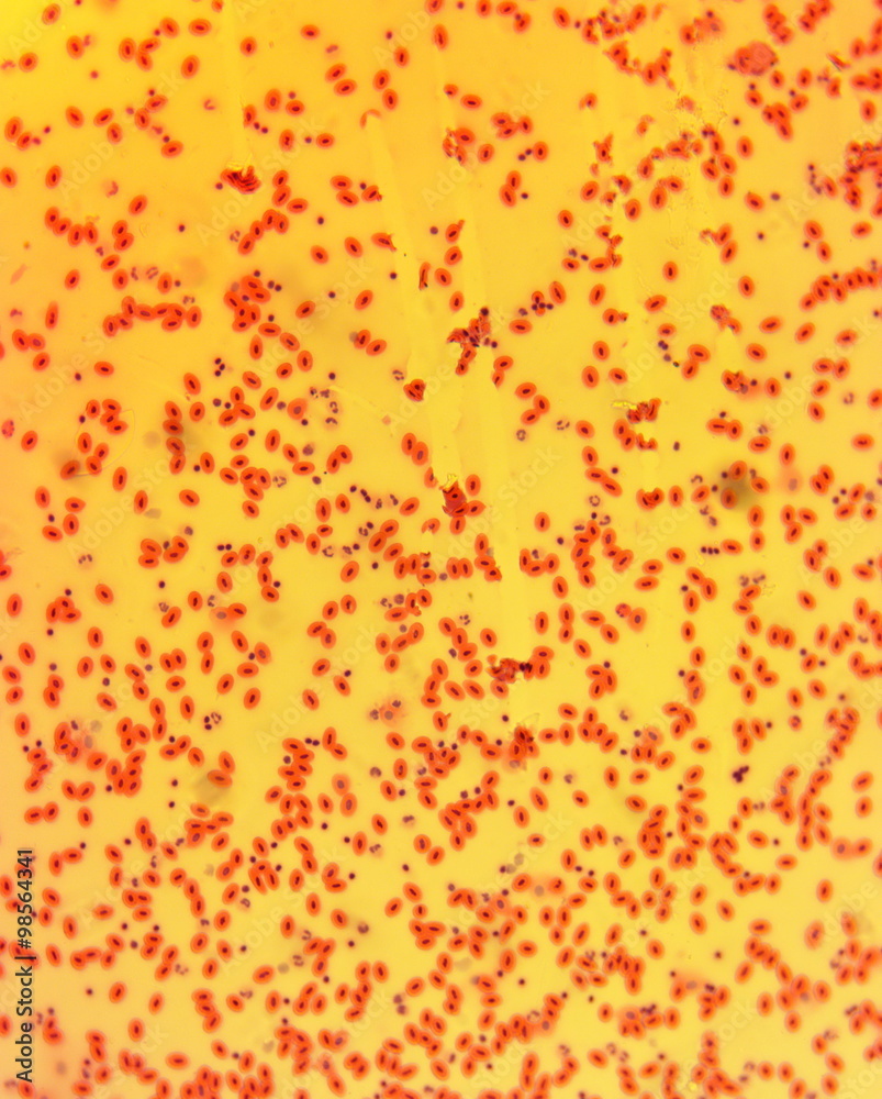 Frog (Rana sp.) blood smear (blood cells) (stained by haematoxylin ...