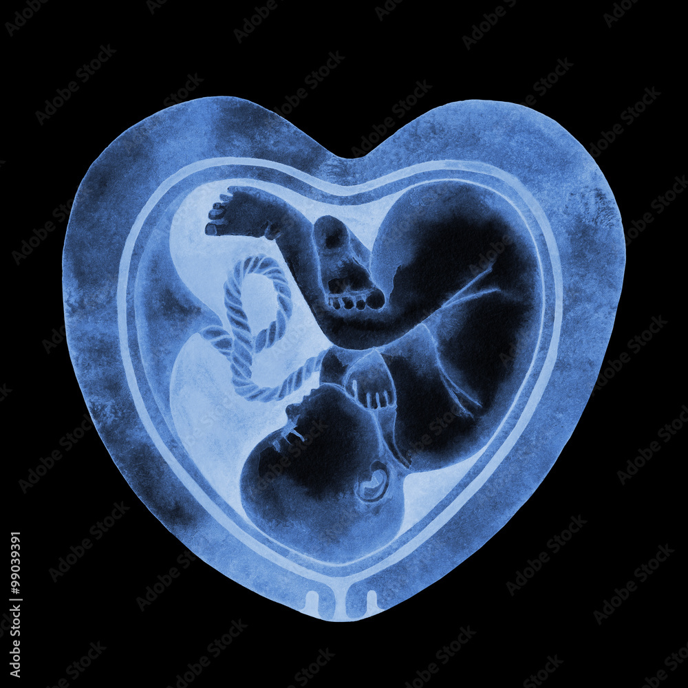 Ultrasound of fetus inside the womb Stock Illustration | Adobe Stock