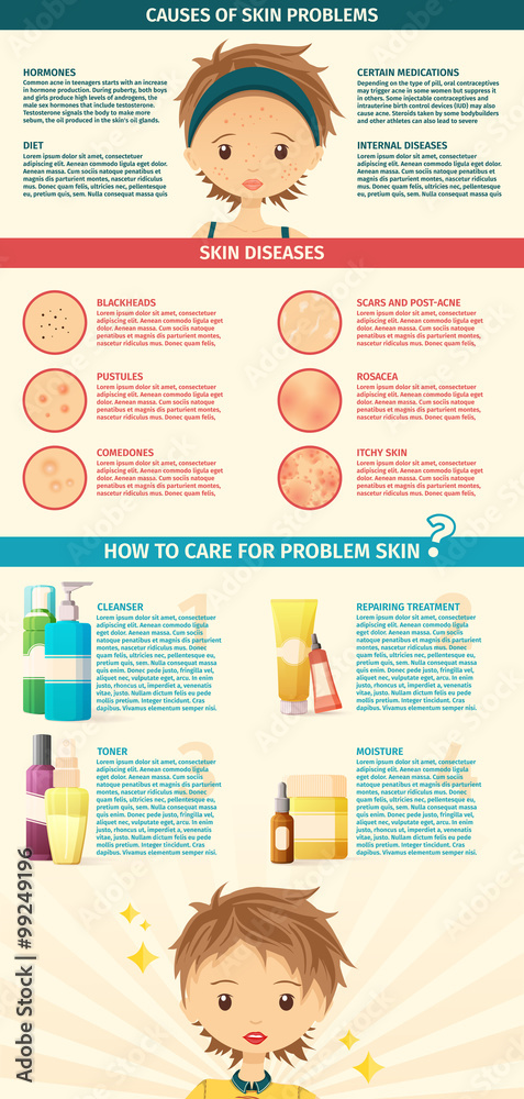 Infographics of the skin problem. Transformation cartoon girl. Types of ...