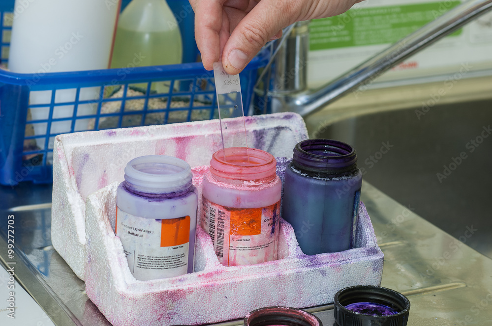 La prise de sang et l’analyse sanguine permettent d’étudier les ...