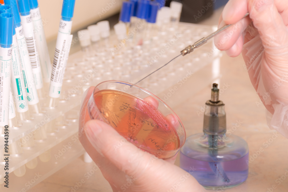 Testing of blood samples for diseases and hormones Stock Photo | Adobe ...