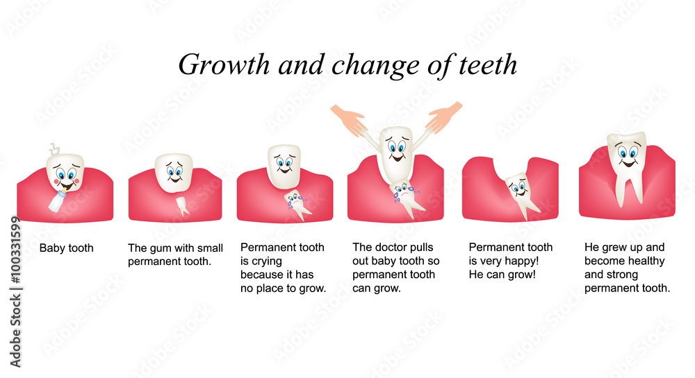 Growth and shift teeth in humans. Stages of development of teeth ...