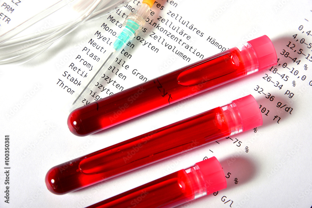 Labor Bluttest Labormedizin Blut Virus Test Impfstoff Stock Photo ...