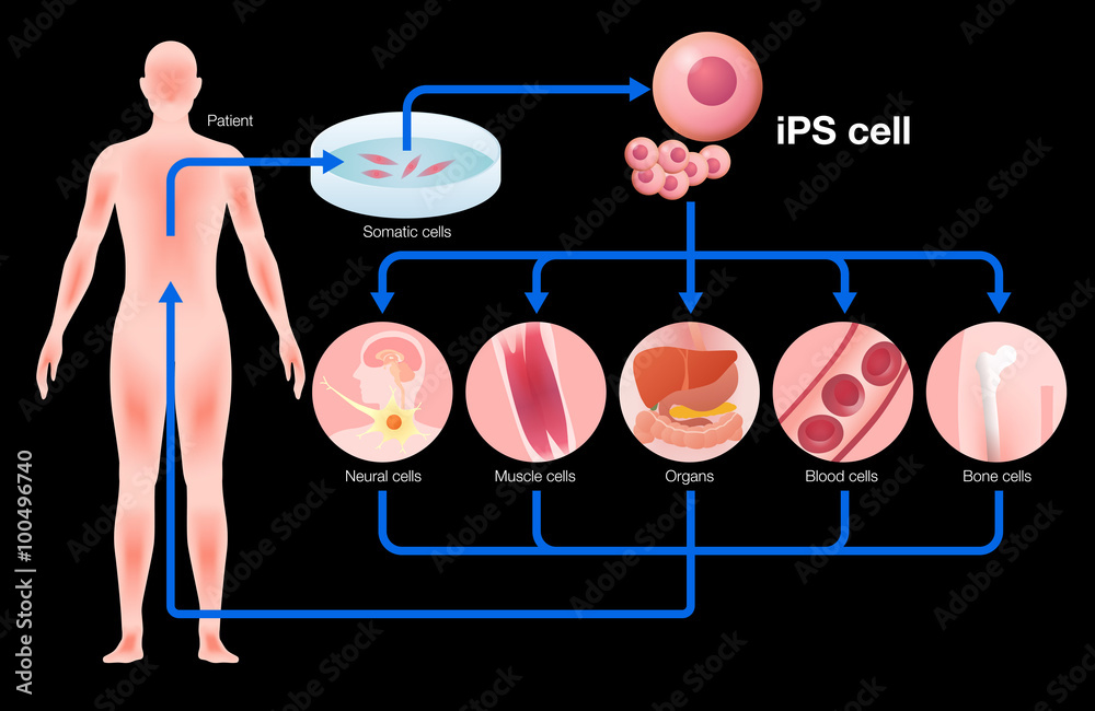 induced pluripotent stem cell (iPS cell) and regenerative medicine ...