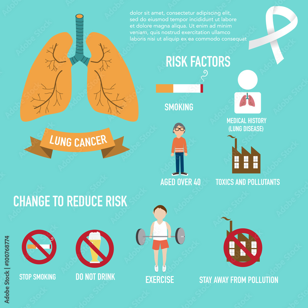 Lung cancer risks and change to reduce infographics illustration Stock ...