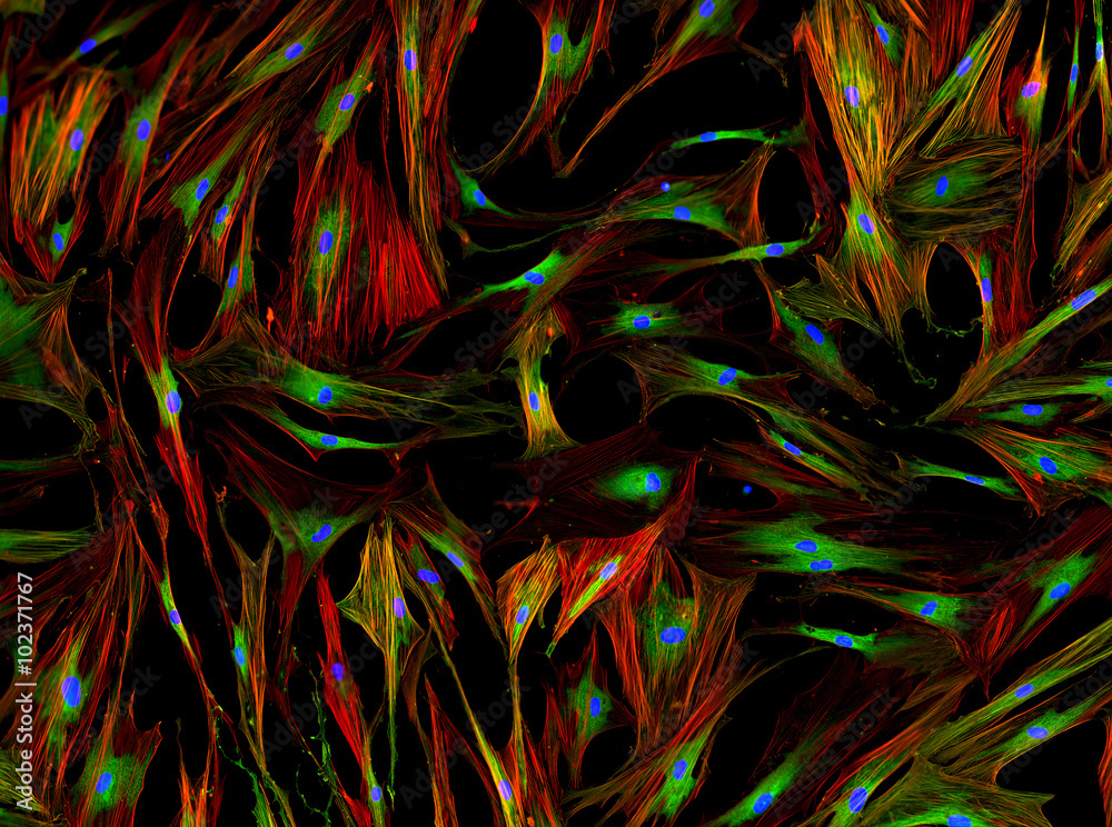 Real fluorescence microscopic view of human cells - human lung f Stock ...