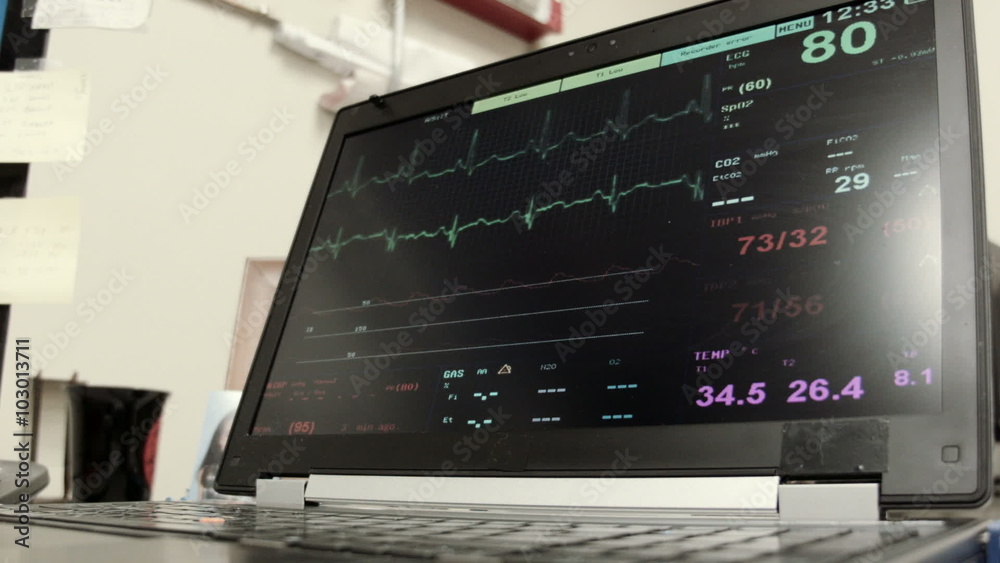 Vitals signs on a laptop in the monitoring station of a medical clinic ...