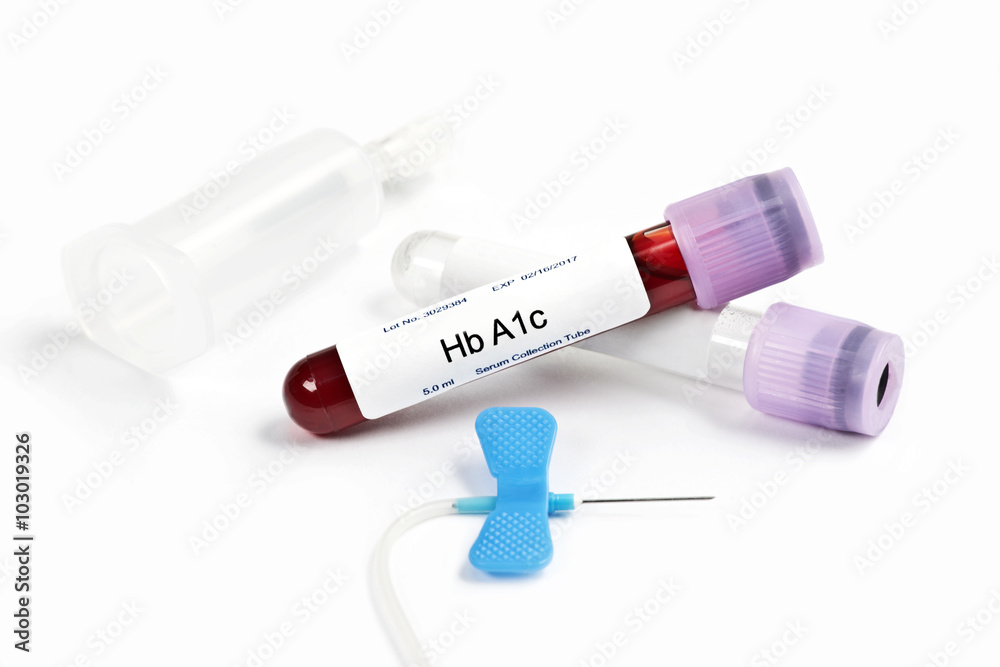 A1c Lab Blood Sample Stock Photo | Adobe Stock