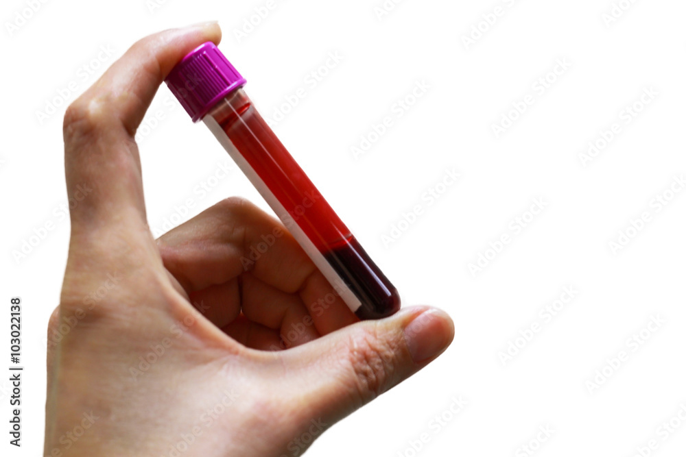 Hand holding blood sample on white background Stock Photo | Adobe Stock