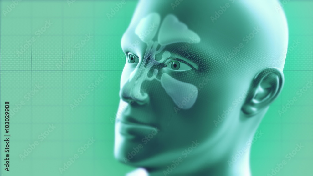 Nasal Sinus Infection Cured by Medicne. Frontal, Ethmoidal, Sphenoidal ...